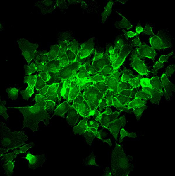 mEER Mouse E6/E7/hRas Oropharynx Epithelial Cell Line | SCC626